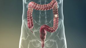 What Does a Normal Colonoscopy Result Mean? Understanding Your Report ...
