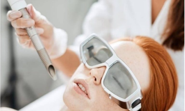 How a 4D Laser Facelift Works for Jawline, Mid-Face, and Perioral ...
